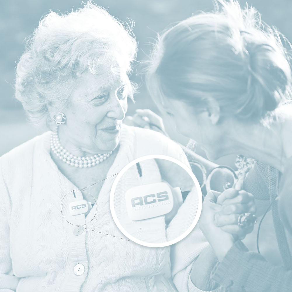 Holter Monitor - Discreet & Reusable CORE Clip - ACS Diagnostics